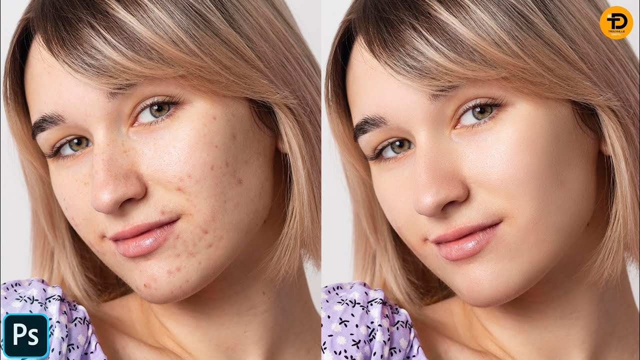 How To Remove Skin Blemishes In Photoshop (2024) - YouTube