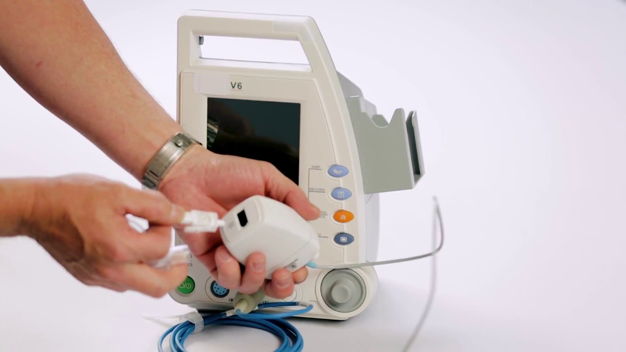 Vital Signs V6 Monitor Set Up - YouTube