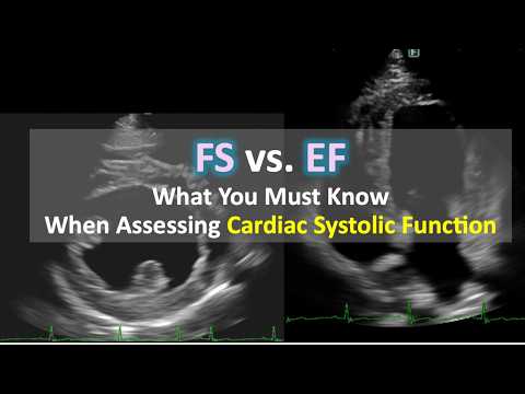 FS vs. EF: Echocardiography - Cardiac Systolic Function - YouTube