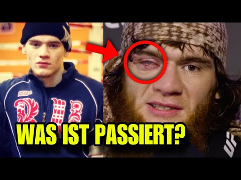 Was ist mit dem Auge von Shara Magomedov passiert?