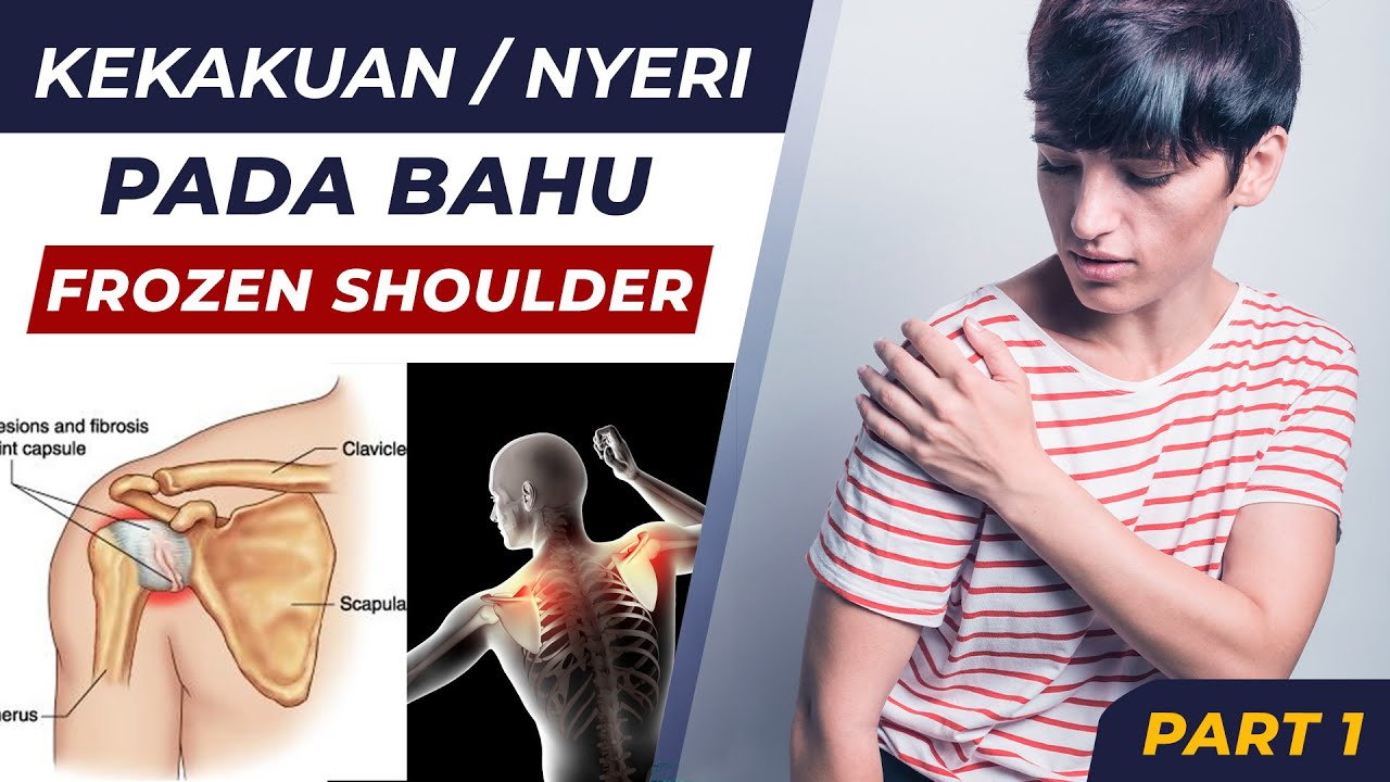 FROZEN SHOULDER - Kekakuan / Nyeri pada Bahu | Part 1 | Fisioterapi ...