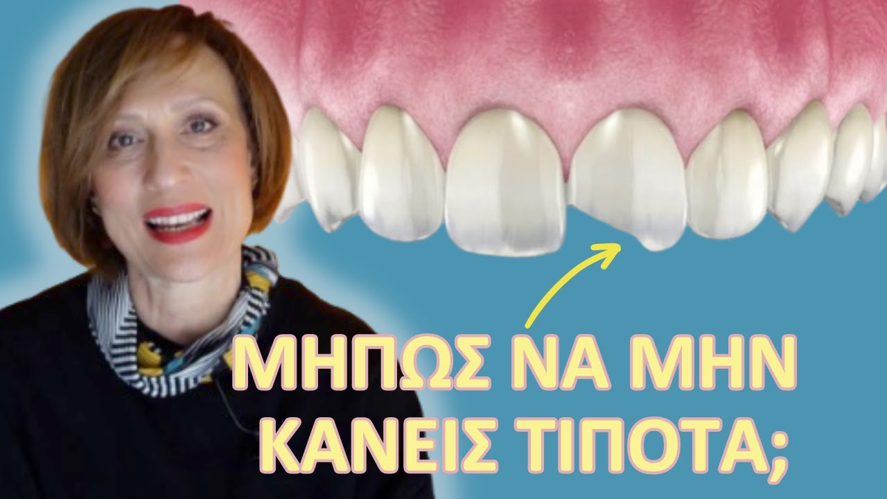 Σπάσιμο στο ΜΠΡΟΣΤΙΝΟ σου δόντι; Τι θα κάνεις; - YouTube
