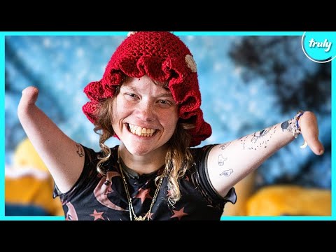 No Hands Or Elbows But Still Found True Love | BORN DIFFERENT