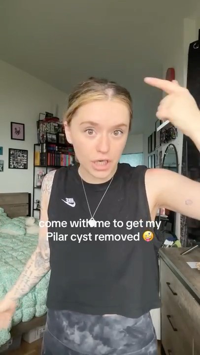 I feel like I have phantom cyst, it somehow feels like it’s still there ...