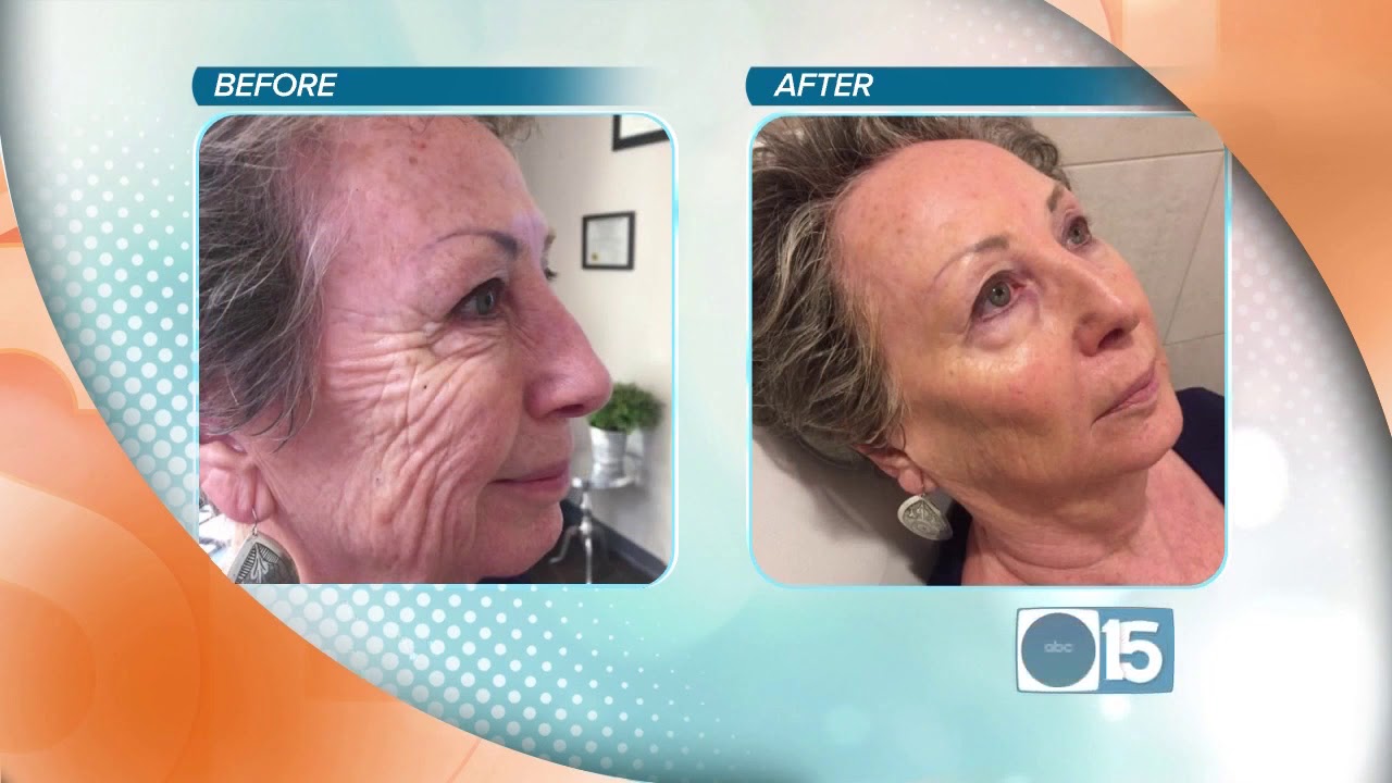 Vibe Med Spas offers up memberships and value for all of your facial ...