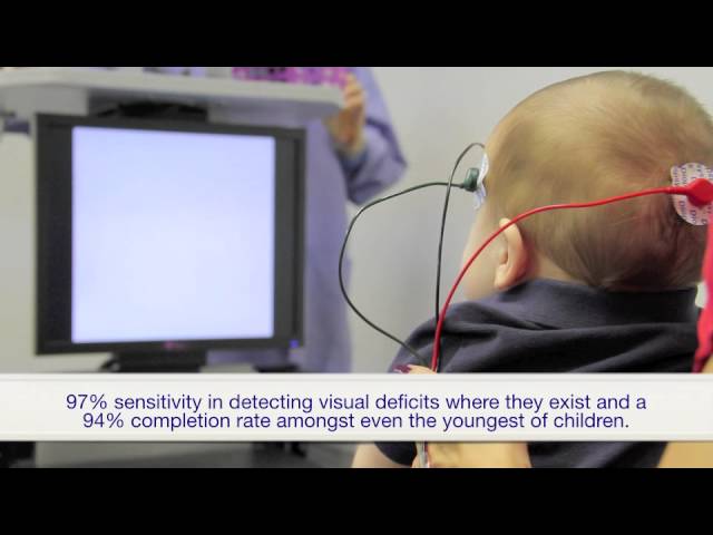Visual Evoked Potential Test For Pediatrics Enfant Visual Field