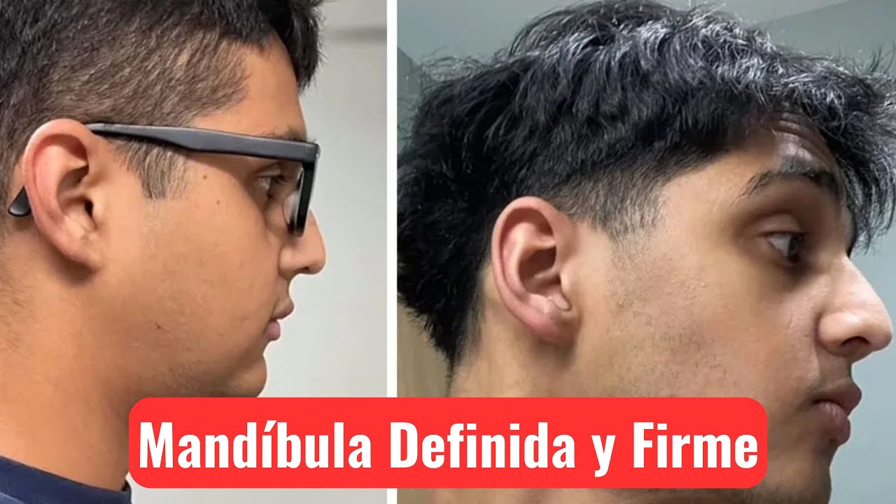 La Clave para una Mandíbula Definida y Firme - YouTube