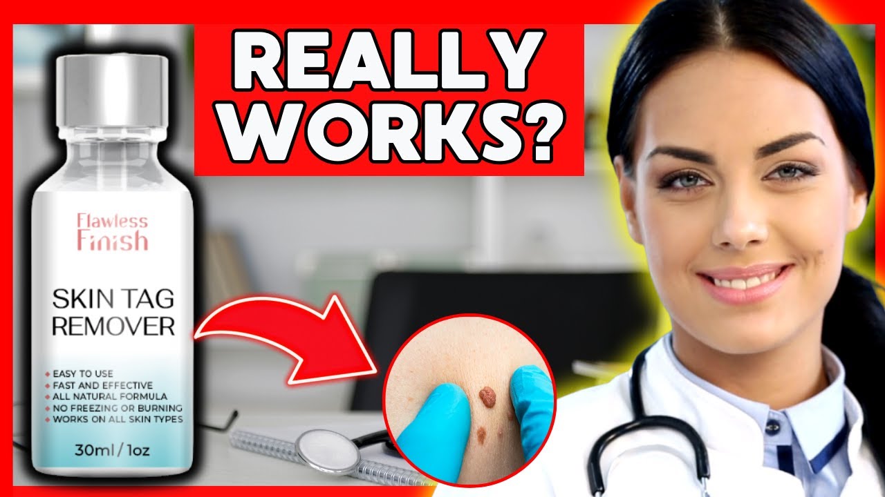 🚨 Flawless Finish Skin Tag Remover: Does It Work? The Effectiveness of ...
