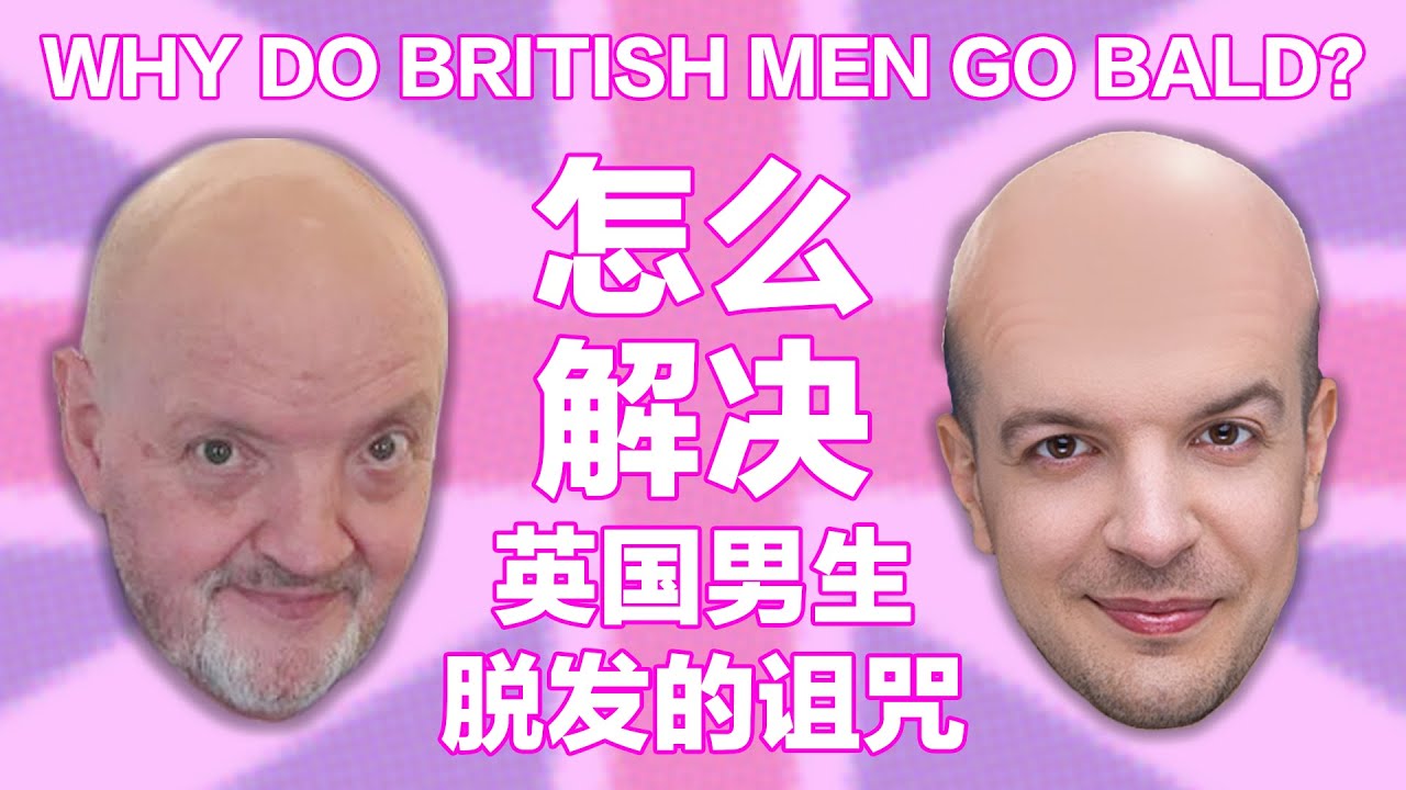 Do All British Men Go Bald? 英国人到底为什么爱脱发？我想摆脱这个魔咒 - YouTube