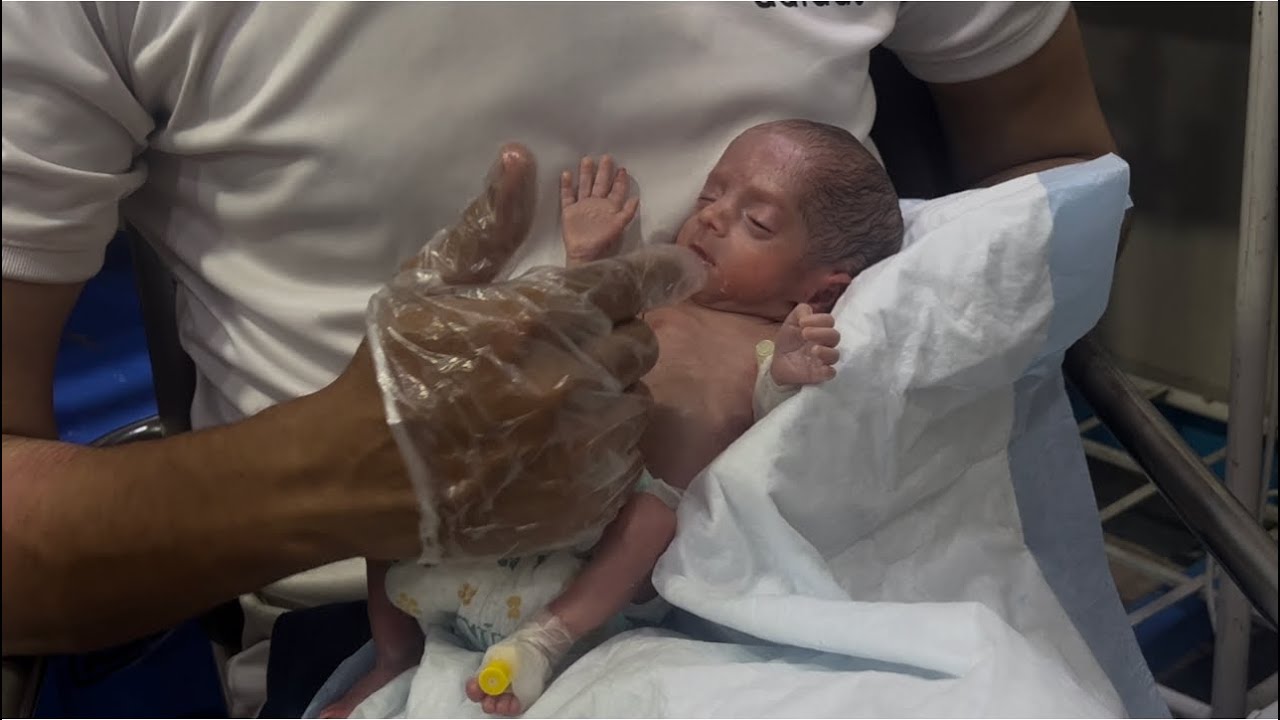 Our Cute Preterm Baby Fully Recovered in NICU | Nutrition & Love Made ...