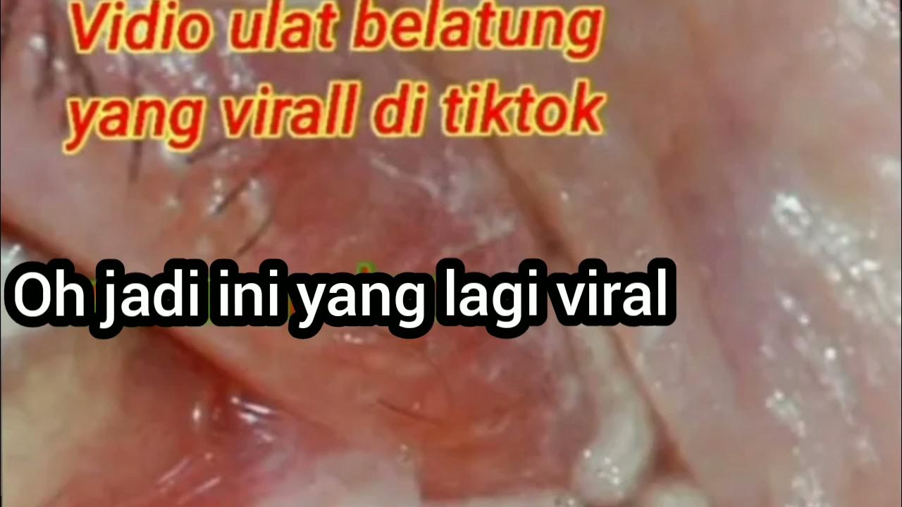VIDEO VIRAL BElATUNG DALAM VAGINA 🤮 VIRAL DI TIKTOK - YouTube