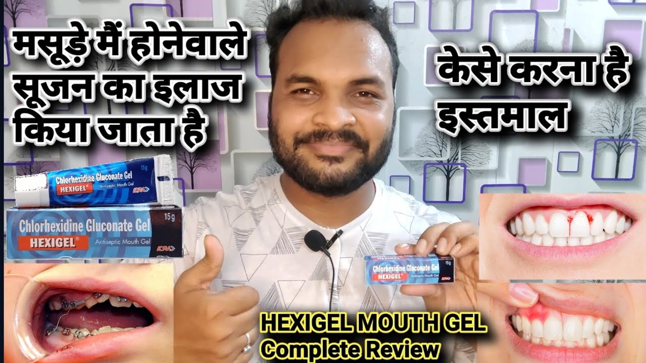 HEXIGEL ANTISEPTIC MOUTH GEL TREATMENT FOR INFLAMATION OF GUM AND MOUTH ...