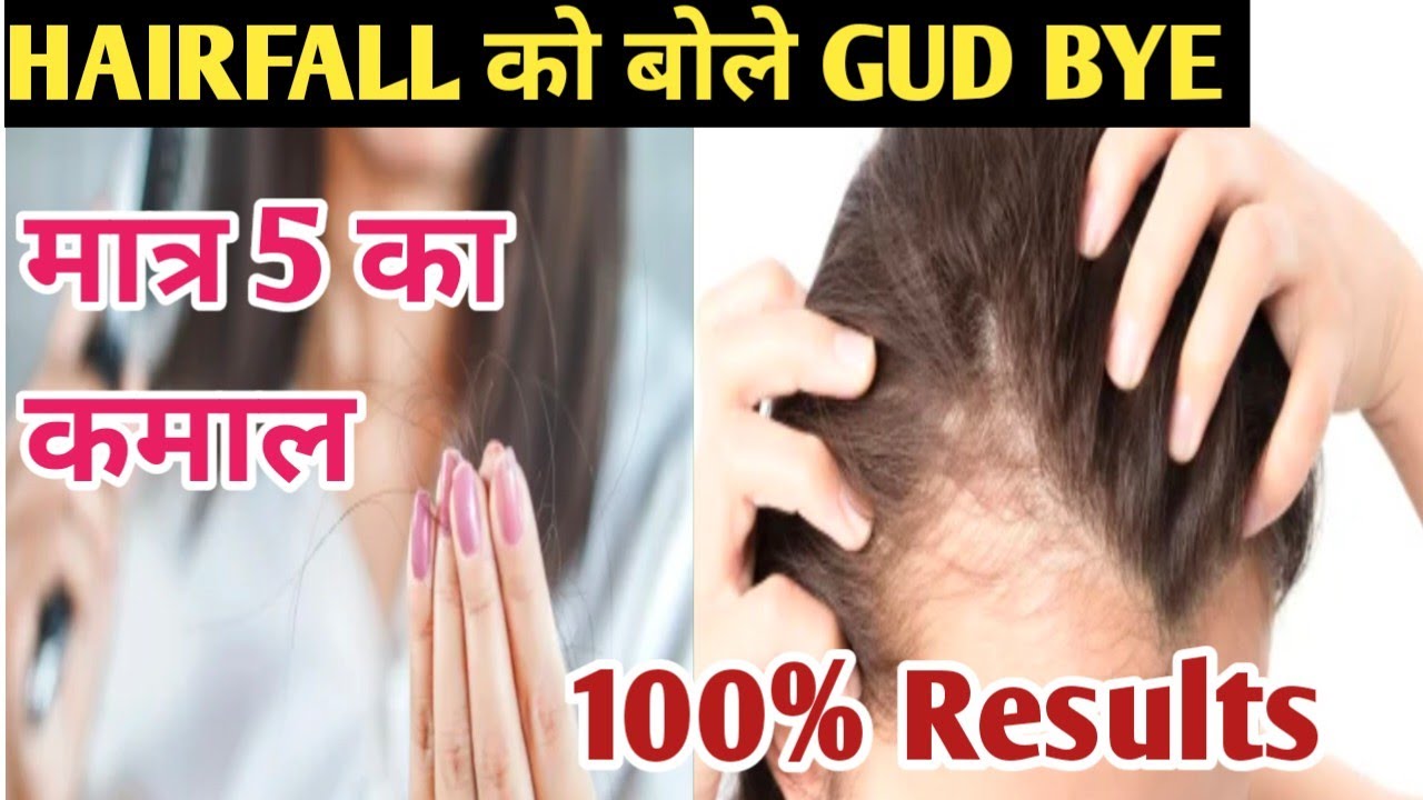 How to stop Hairfall | Hair Fall Soluation | Home Remedies For Hair ...