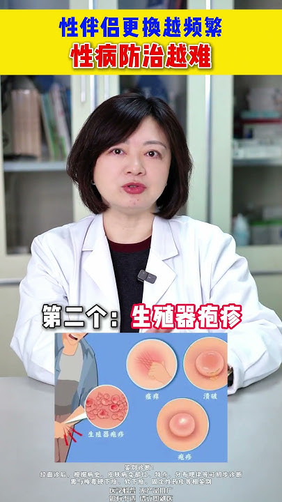 性伴侣更换越频繁，性病防治越难梅毒 艾滋 两性 关爱健康 抖出健康知识宝藏 Youtube