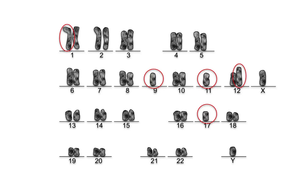 BCR-ABL1 and the Philadelphia chromosome - Part 1: Normal and aberrant ...