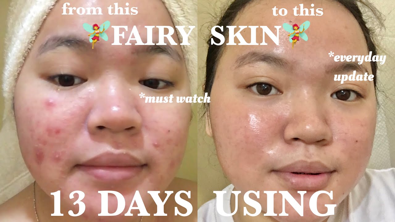 13 DAYS USING FAIRY SKIN PREMIUM BRIGHTENING KIT| HONEST REVIEW ...