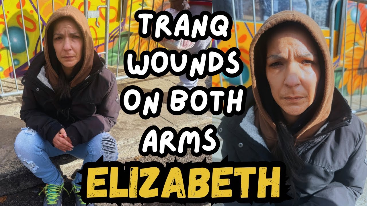 Tranq Is Eating My Nose - Elizabeth Interview - YouTube