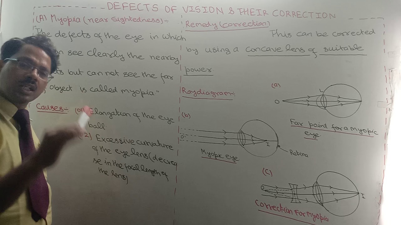 Class 10 MYOPIA IN HUMAN EYE - YouTube