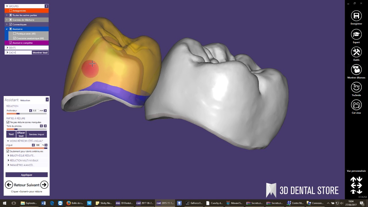 exocad : Réduction anatomique - YouTube