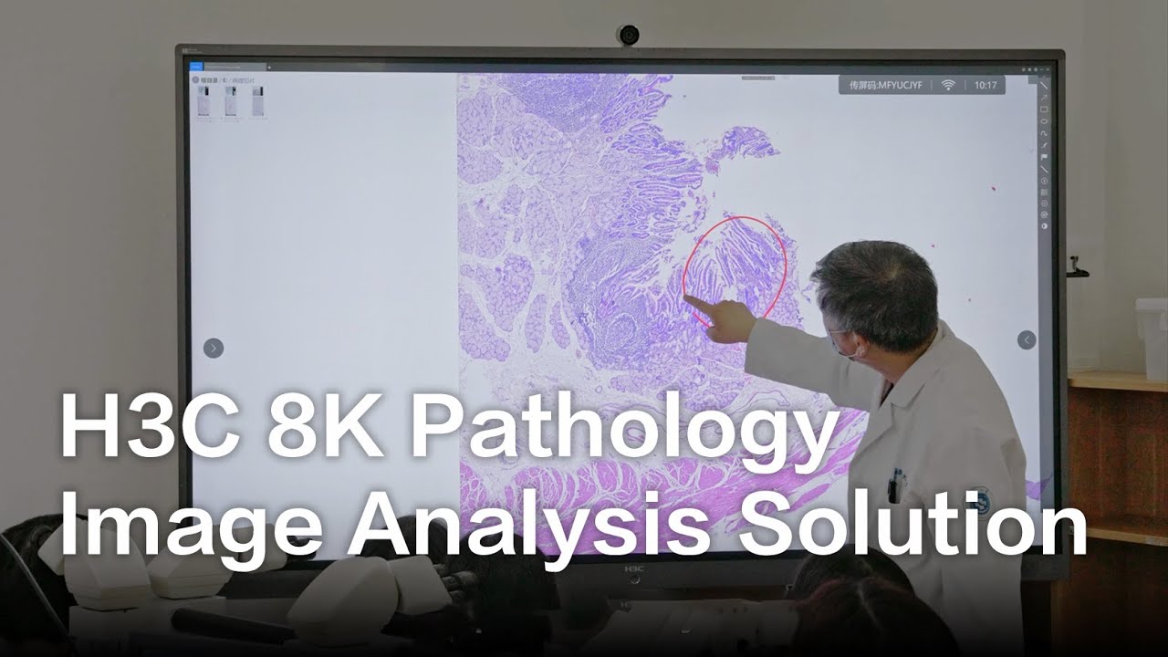 H3C 8K pathology image analysis solution enables more precise pathology ...