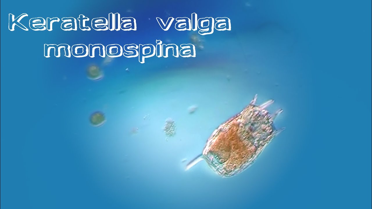 Keratella Valga monopsina - YouTube