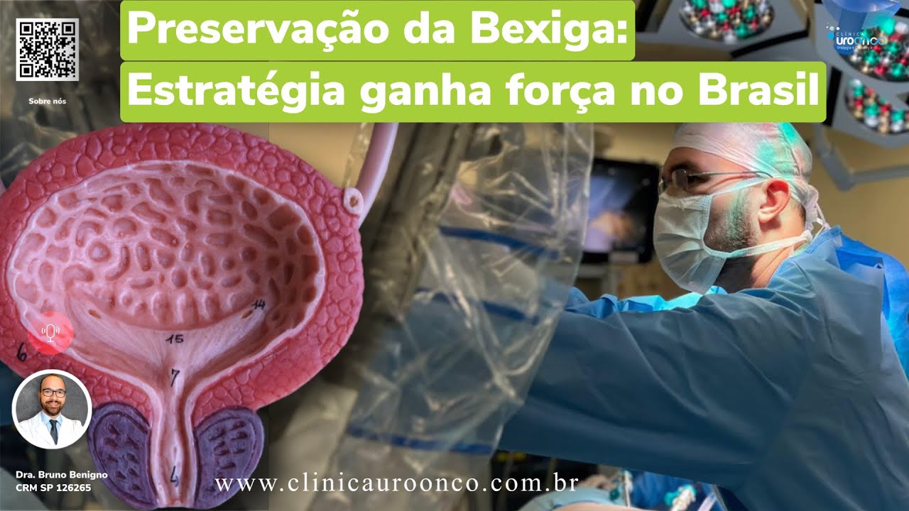 Câncer de Bexiga Invasivo: Por Que a Terapia Combinada de Preservação ...