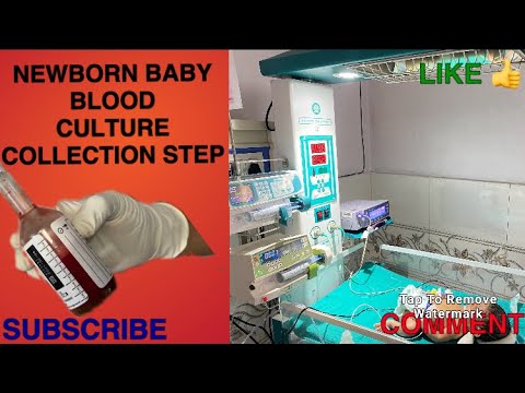 Newborn baby blood Culture Collection Step? नवजात शिशु में Blood ...