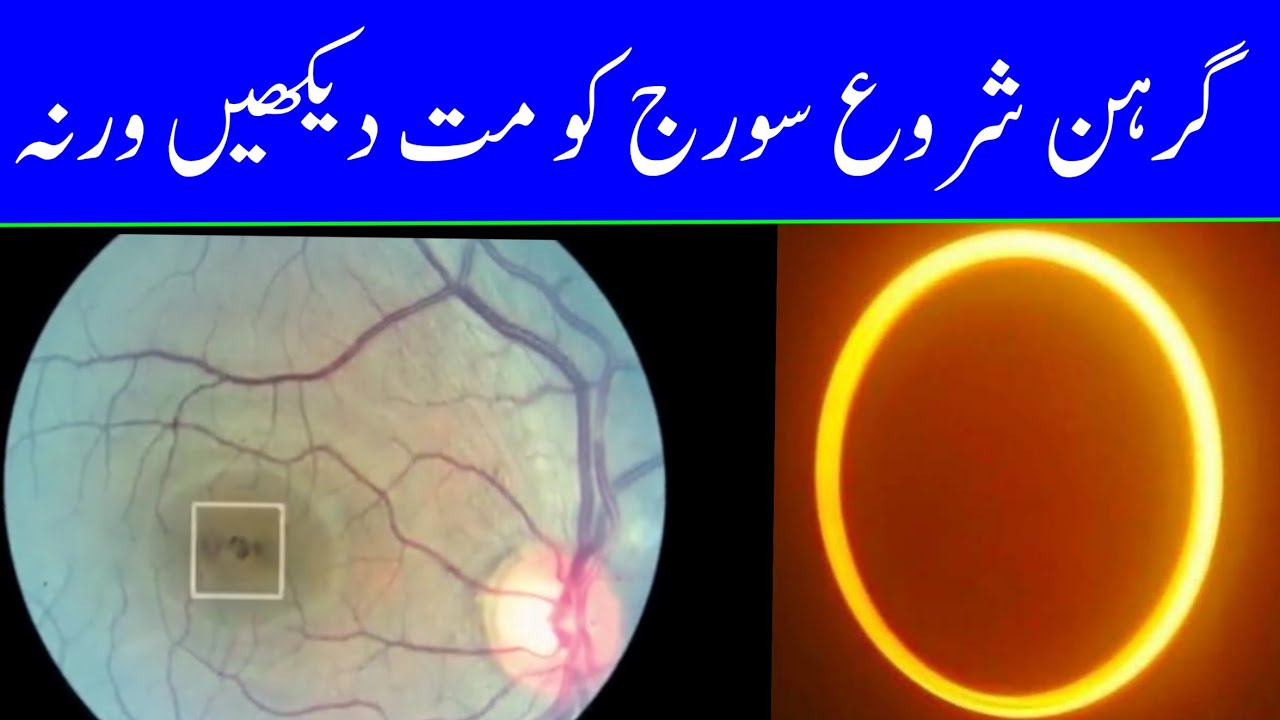 Eclipse eye damage 2021Solar eclipse Harmfull for Eyes |Suraj girhan ...