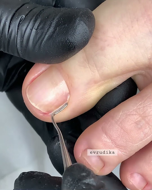 Смотри как правильно установить Каполин если ты вдруг ошибся - YouTube