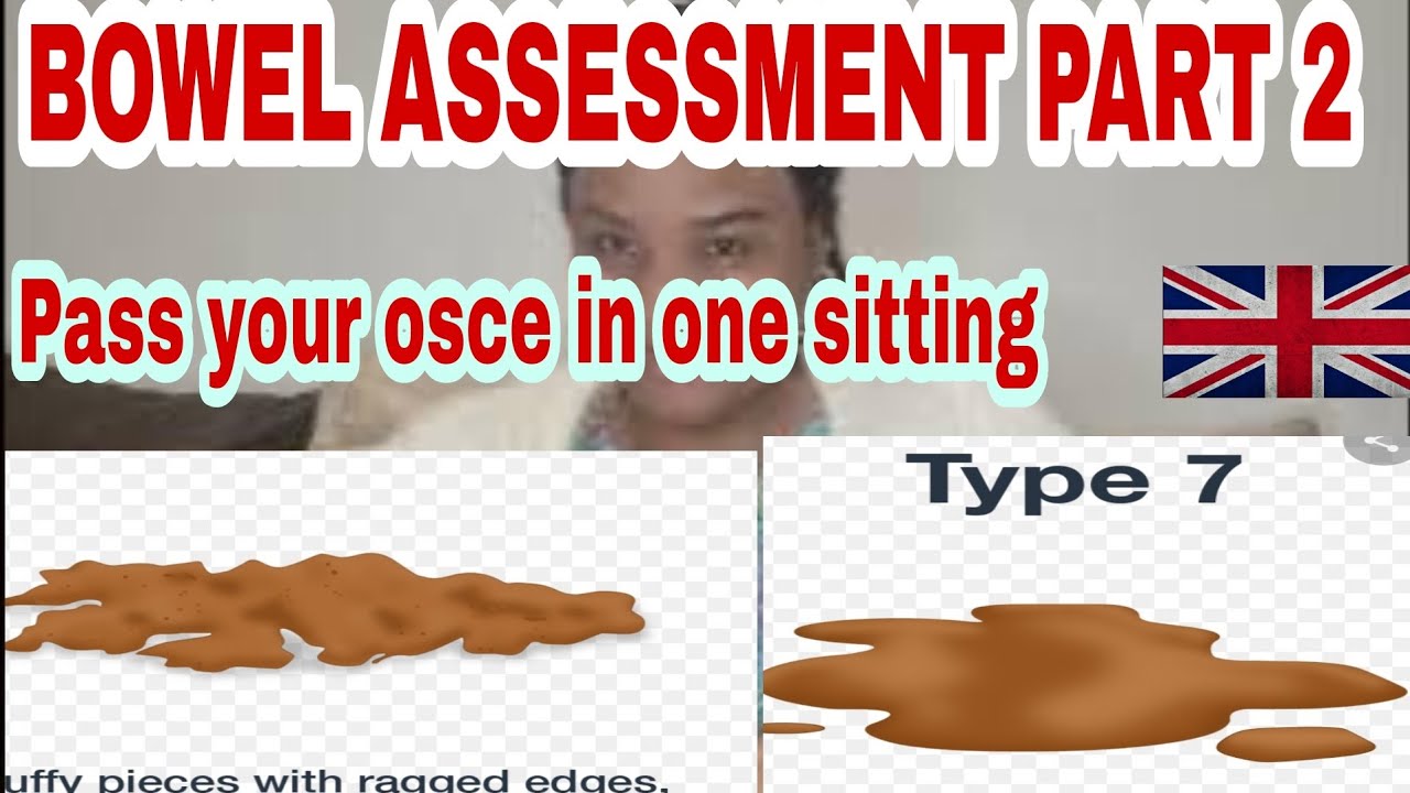 BOWEL ASSESSMENT PART 2 TYPE 6 AND TYPE 7 SIMPLIFIED NMC OSCE MADE bowel-assessment-part-2-type-6-and-type-7-simplified-nmc-osce-made