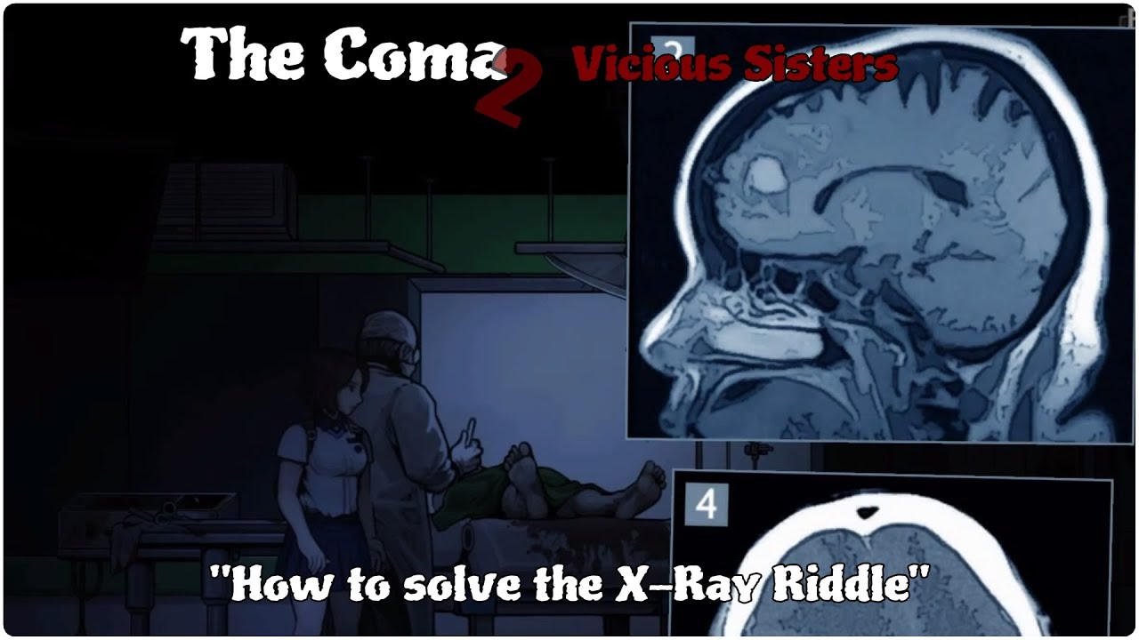 THE COMA 2: Vicious Sisters "How to solve the X-Ray Riddle" - YouTube