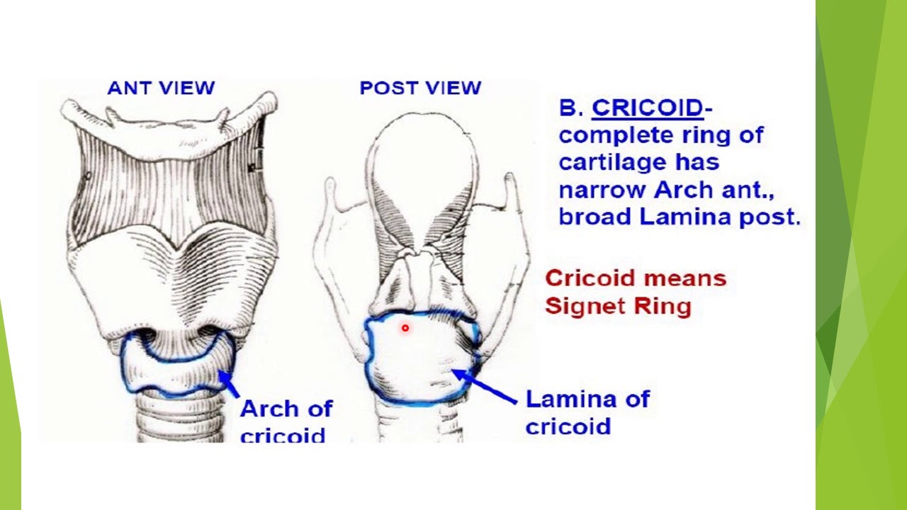Laryngeal Cleft Diagram