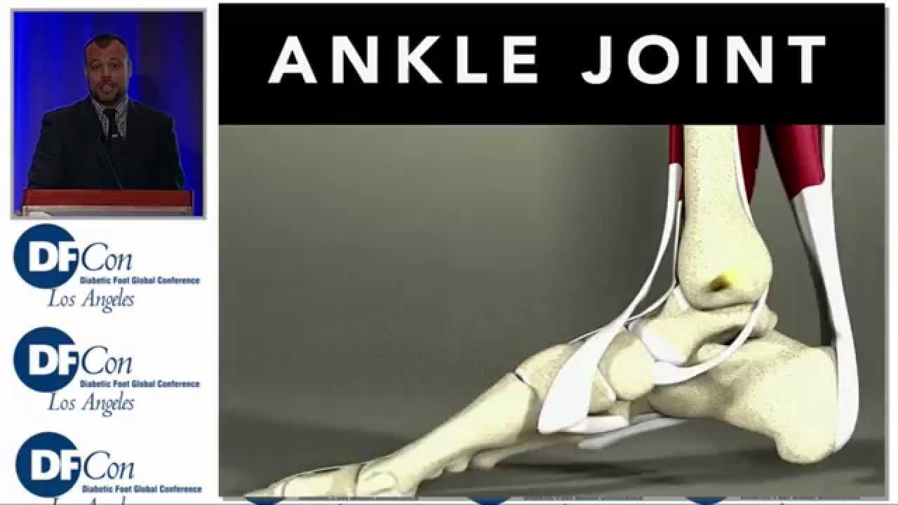 DFCON 2015: Tendon Transfer for TMA - YouTube