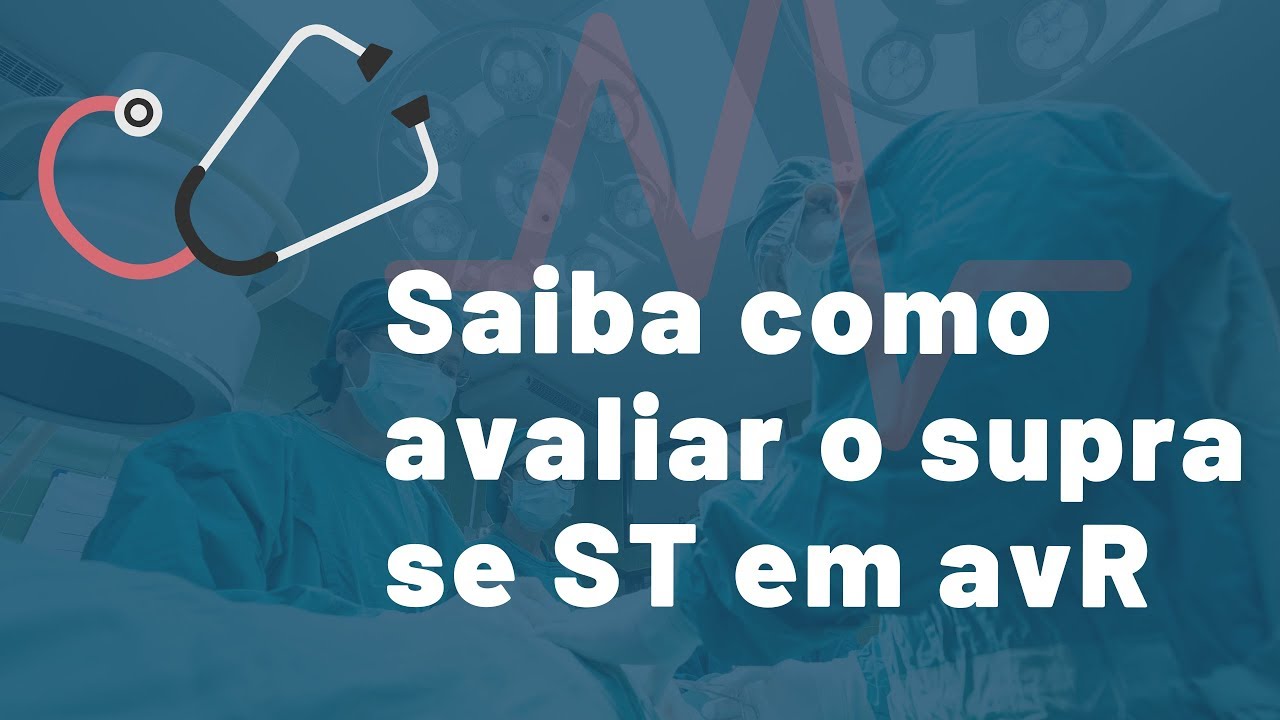 Saiba como avaliar o supra de ST em avR - YouTube