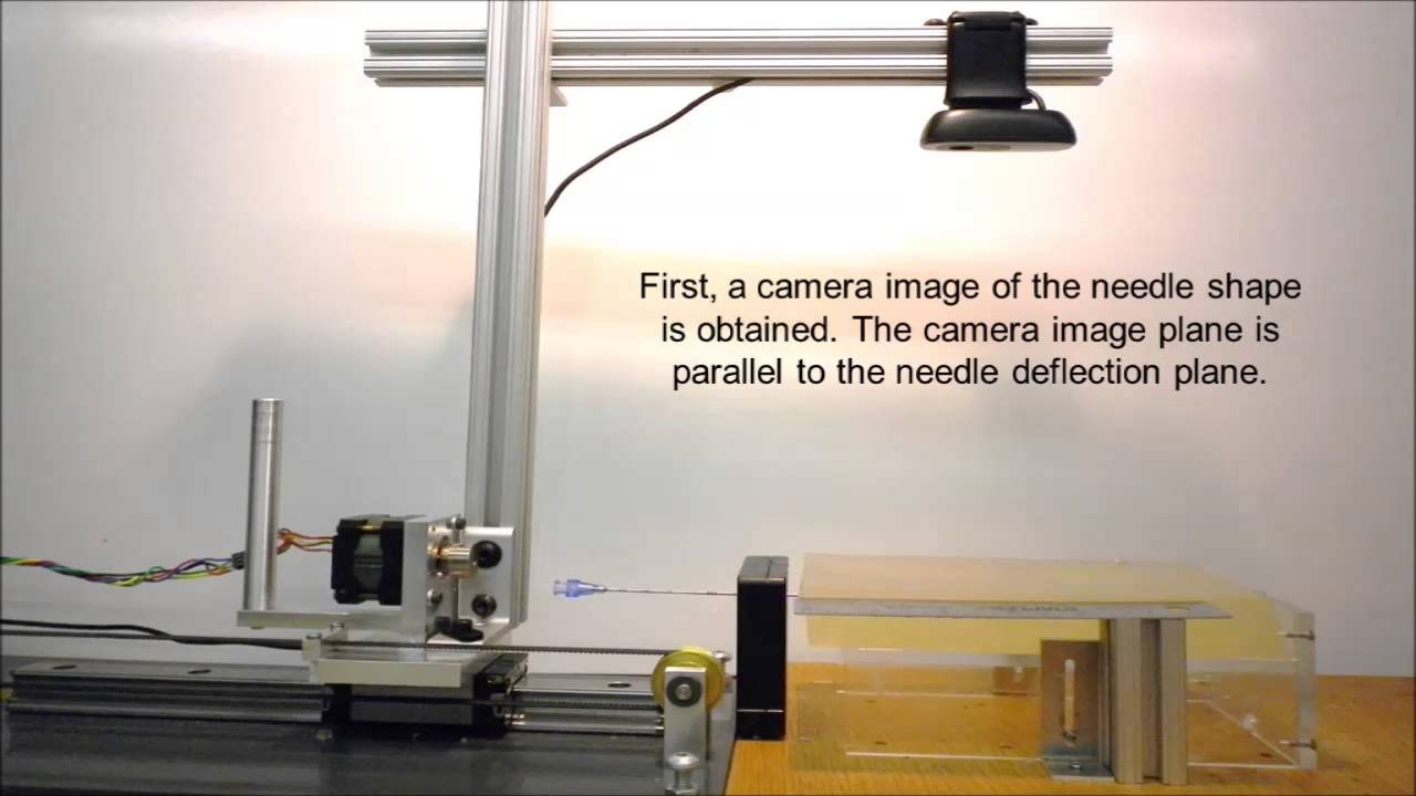 3D Needle Shape Visualization from 2D Ultrasound Images using RANSAC ...