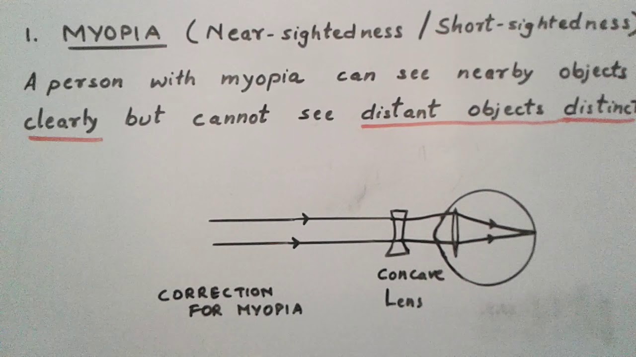 Defects of Vision and It's Correction - YouTube