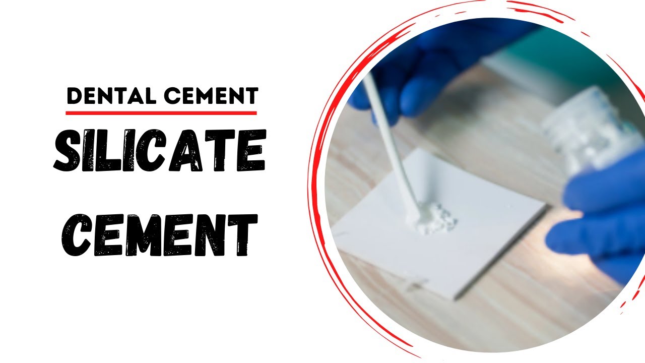 Silicate Cement Dental Cements YouTube