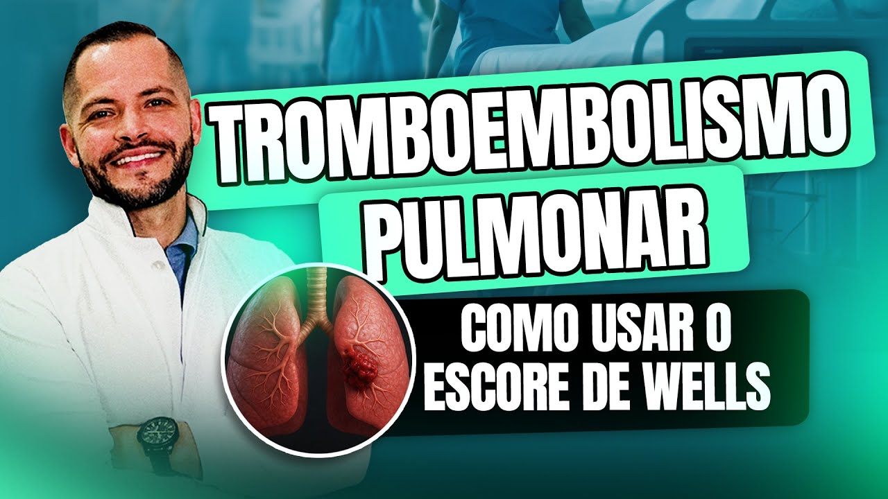 Escore de Wells no Tromboembolismo Pulmonar - YouTube