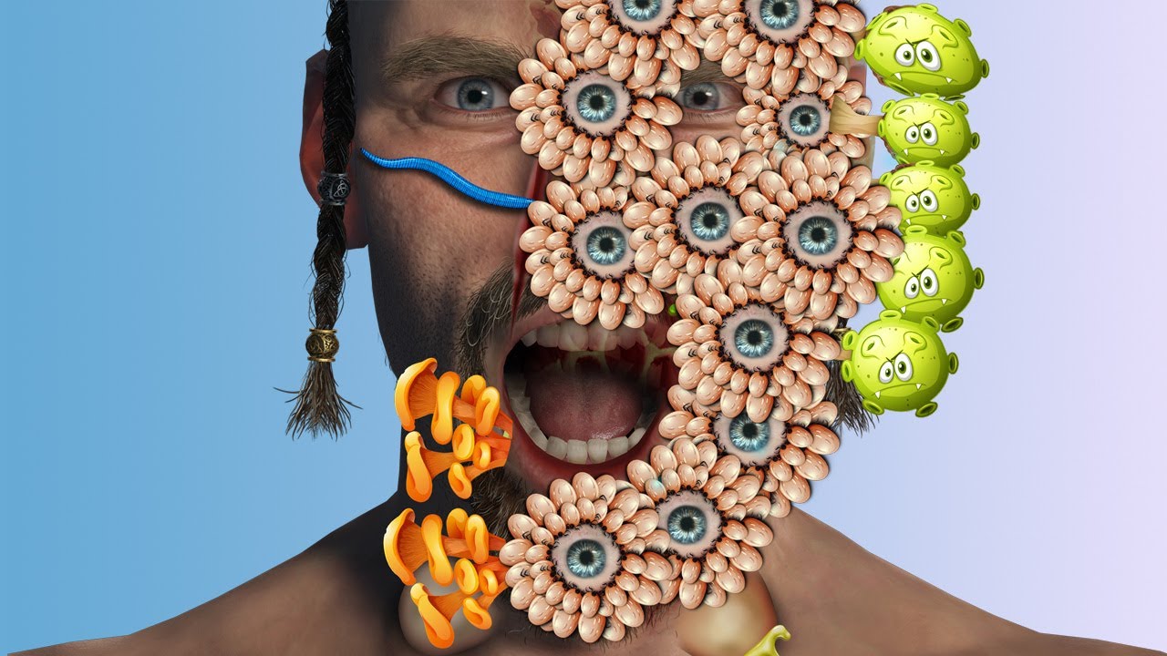 ASMR Remove Maggots & Eye Dog ticks Infected Face | Severely Injured ...