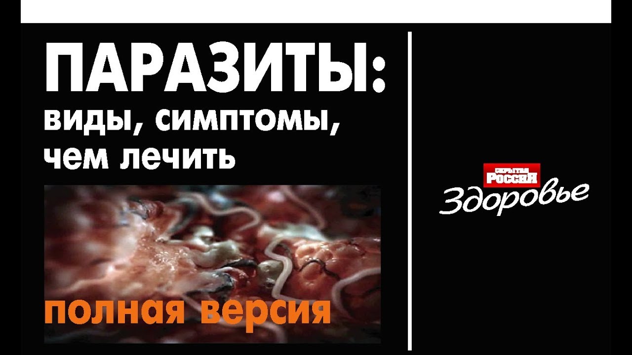 ПАРАЗИТЫ: виды, симптомы, лечение. Полная версия лекции Наталии ...