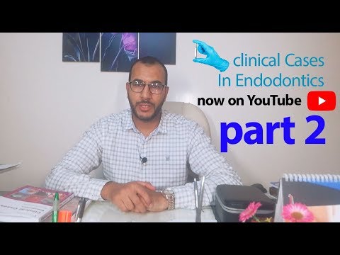 Clinical Cases in Endodontics part 2 - YouTube