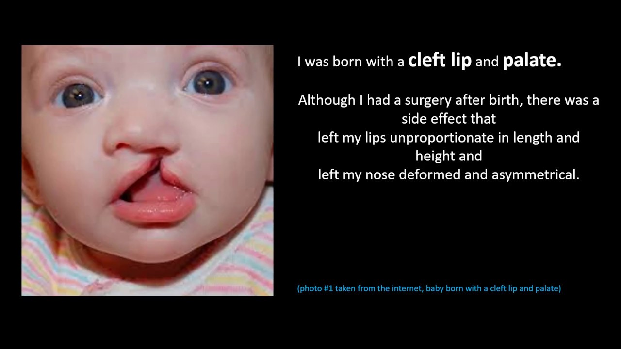 GEN ED 2 PHOTO ESSAY: Discrimination against the misfortunate ...