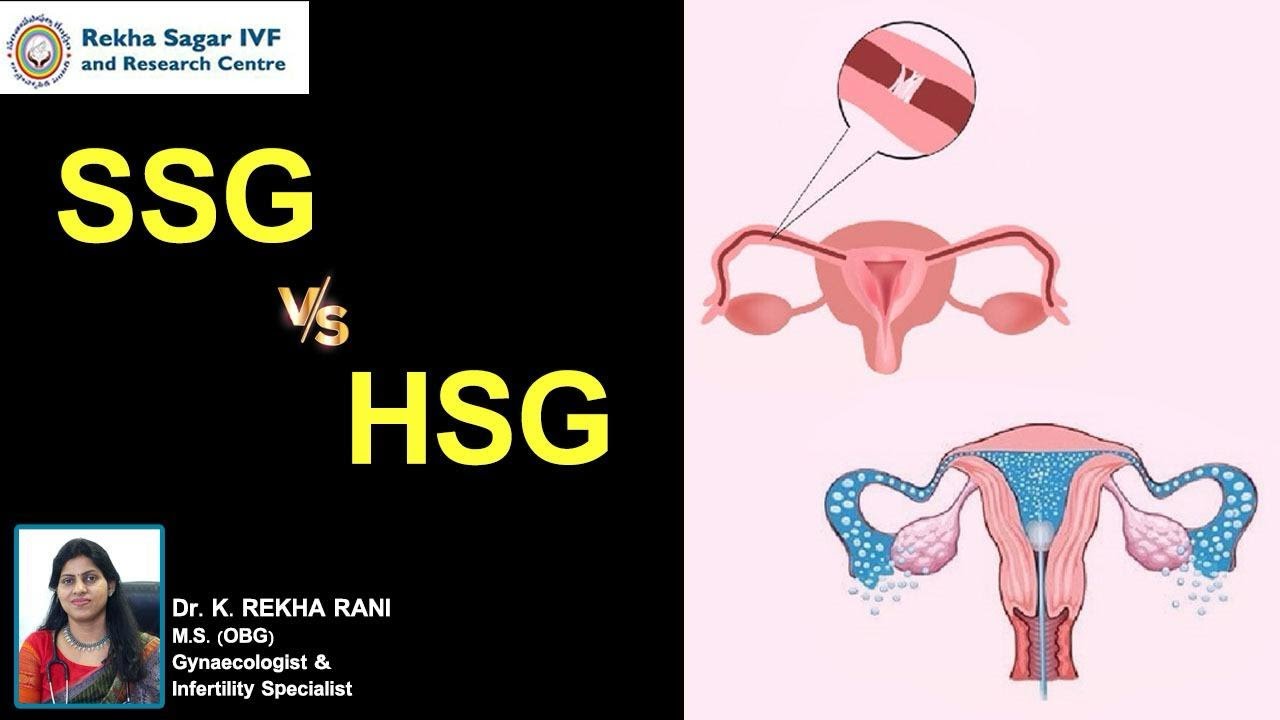 Tube Test లో HSG & SSG అంటే ఏంటి ? Dr. Rekha Sagar || IVF and Research ...