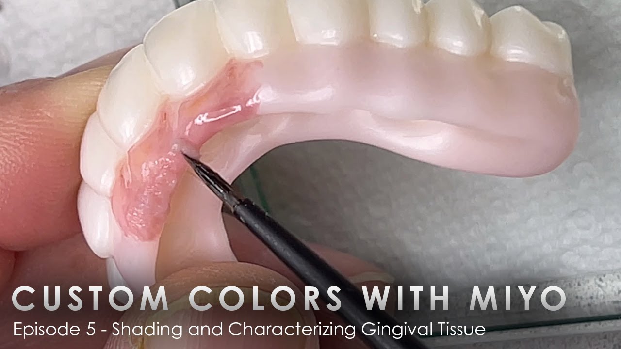 Custom Colors with MiYO: Shading and Characterizing Gingival Tissue - YouTube