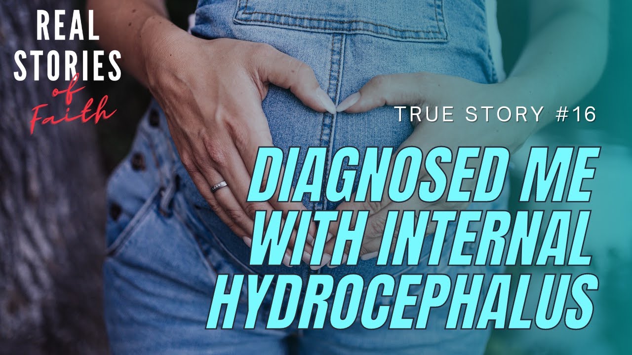 Doctors Diagnosed Me w/ Internal Hydrocephalus // Real Christian ...
