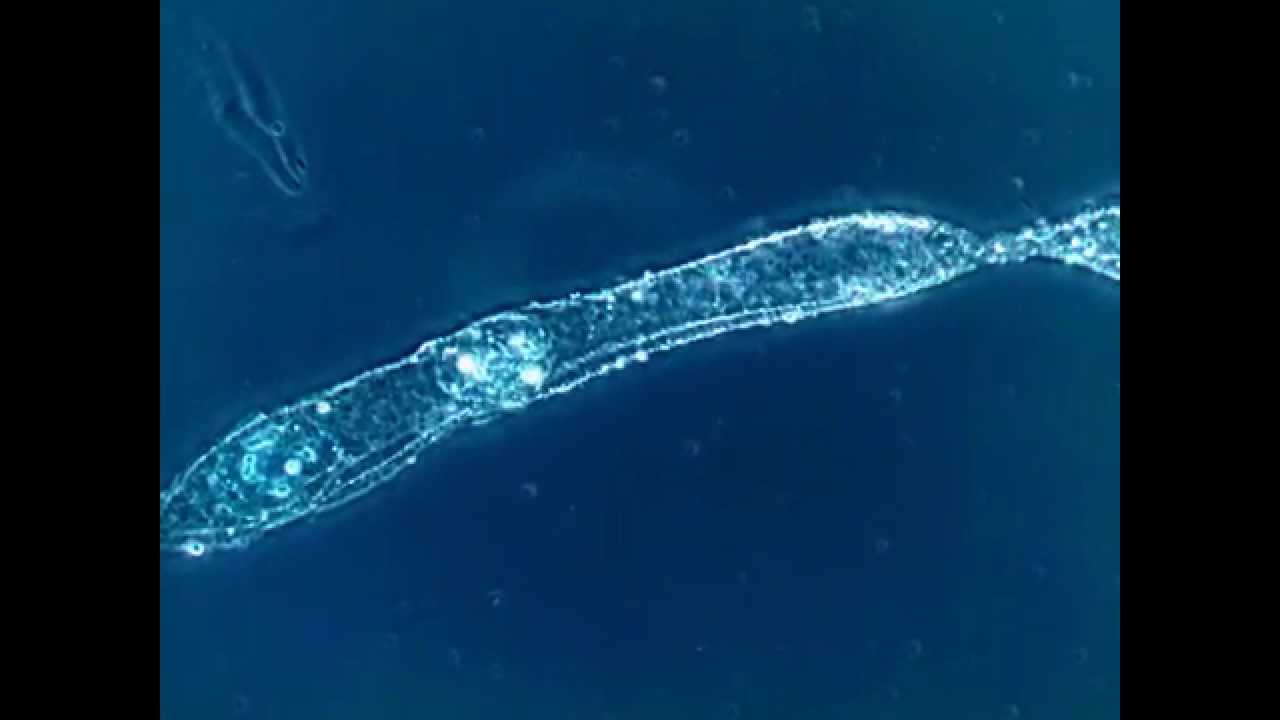 Mesozoan 400x phase contrast - YouTube