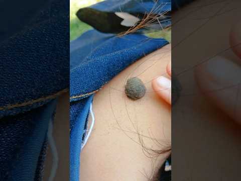 Tahi lalat #diy #kreatif #viral #art #craft #madep