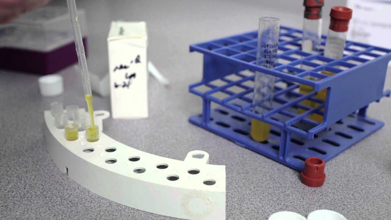 Vet Axcel Clinical Chemistry System - YouTube