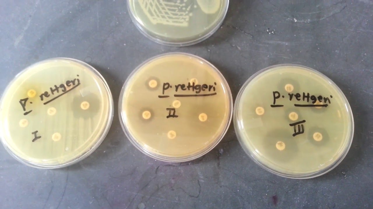 Providencia rettgeri - YouTube