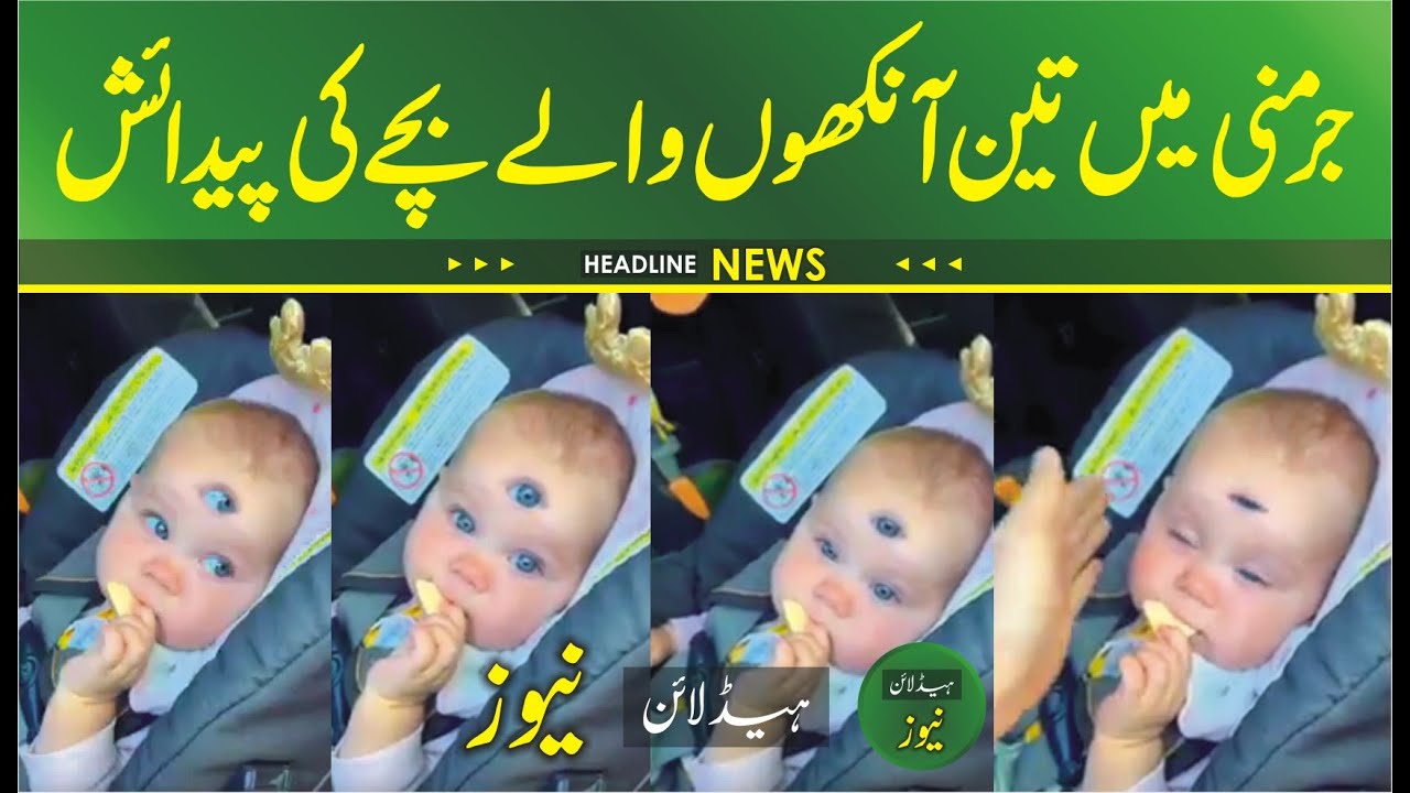 3 eye baby born in garmeny | new born baby with three eye | baby born ...